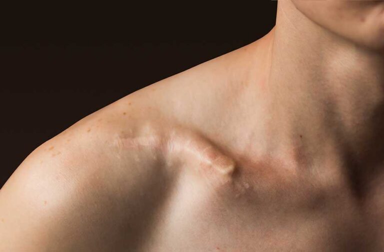 Home - The Anser Clavicle Pin