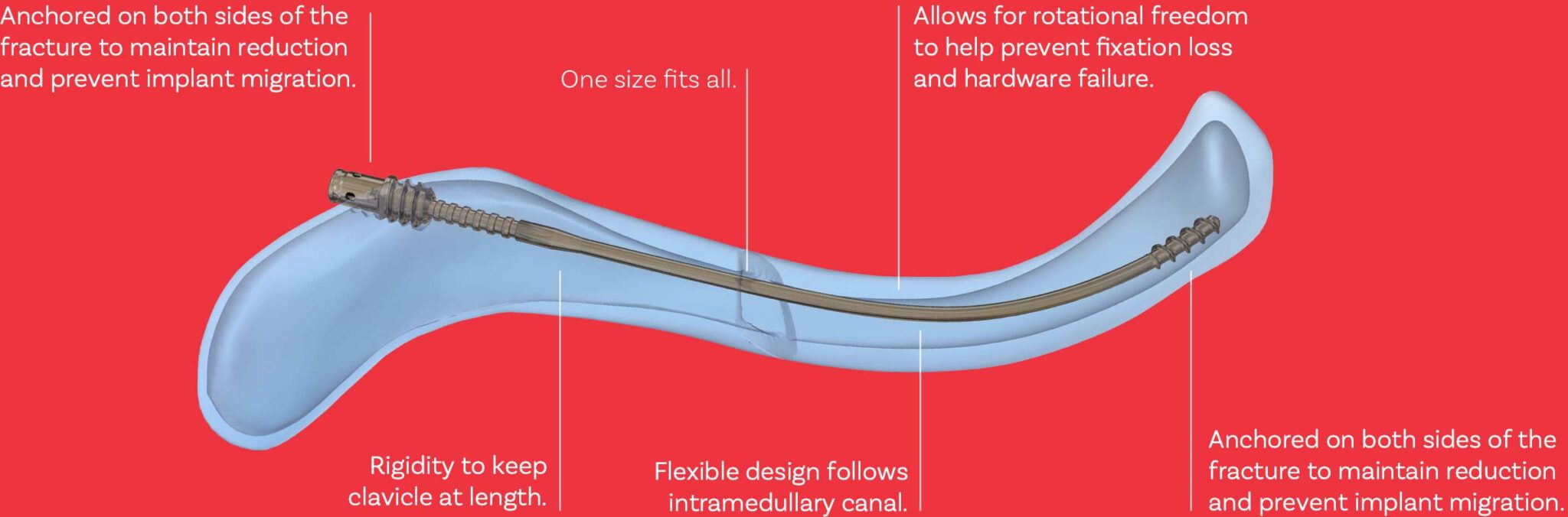 Surgeons - The Anser Clavicle Pin