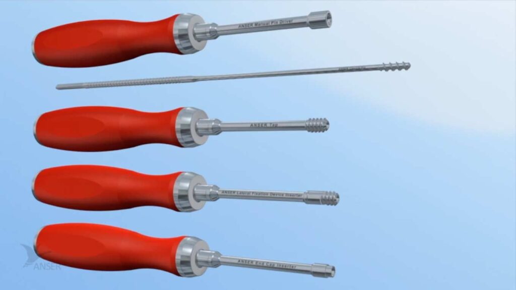 Surgeons - The Anser Clavicle Pin